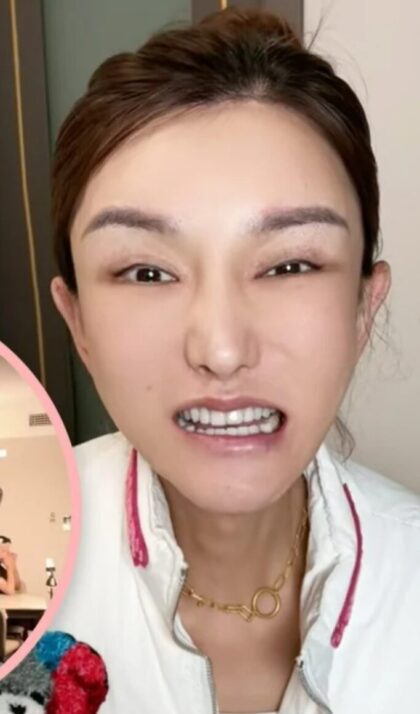 Transgender Influencer's Botched Feminization Plastic Surgery Sparks ...