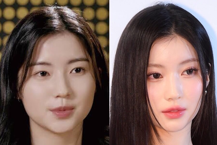 Plastic Surgery Accusations For BABYMONSTER's Asa Go Viral - Koreaboo