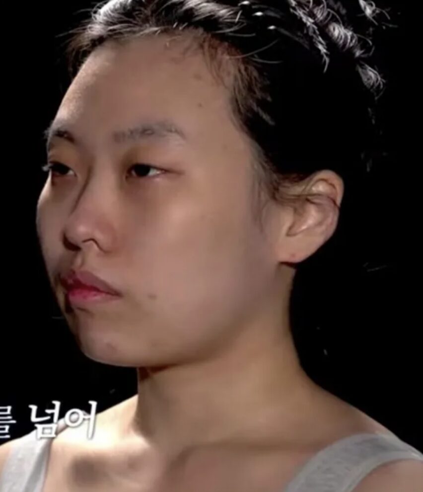 Plastic Surgery Show Sparks Backlash For Unnatural And Uncanny Results ...