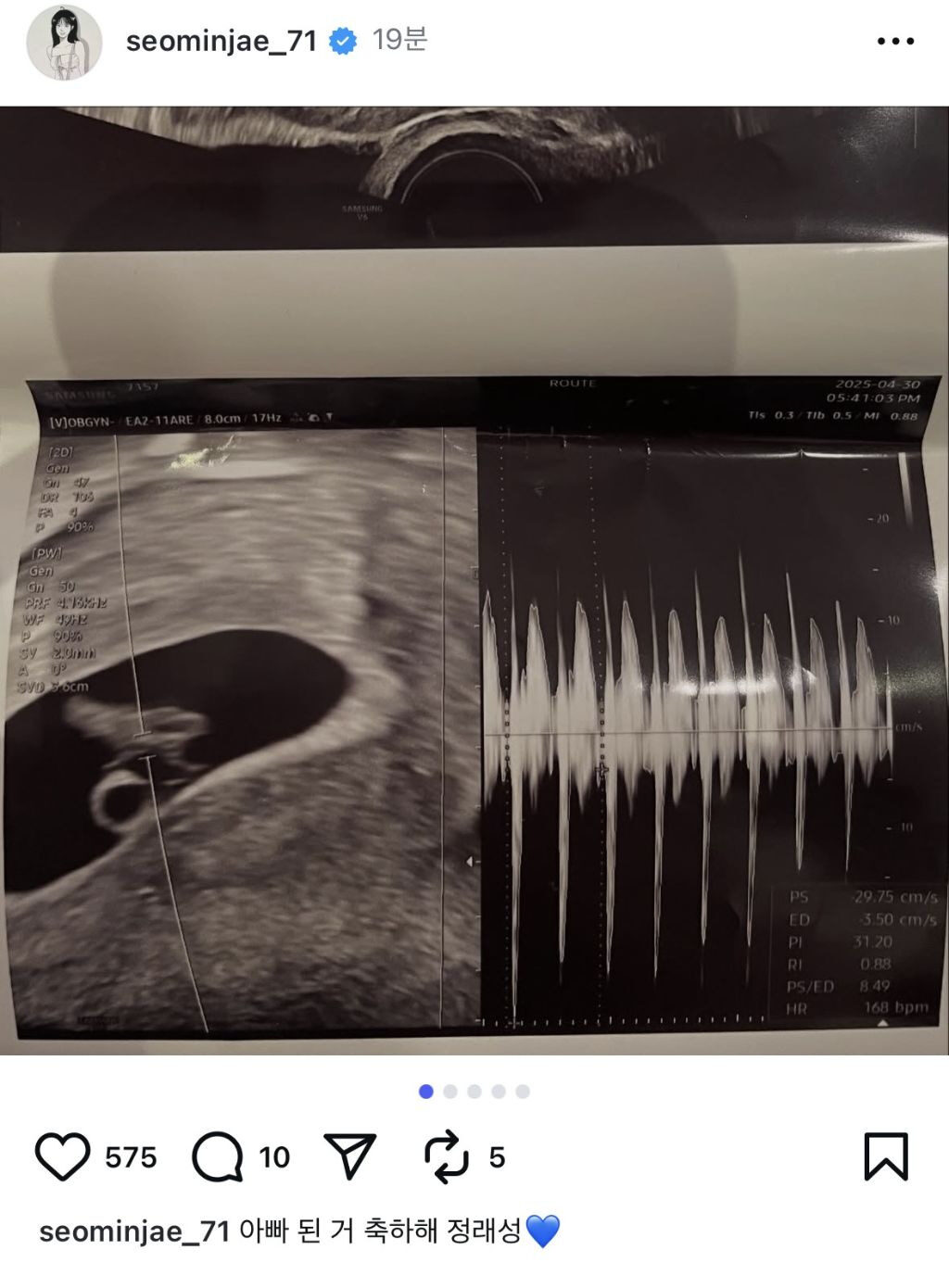 Beloved 'Heart Signal' Star Reveals Pregnancy And New Romance - KPOP HIT