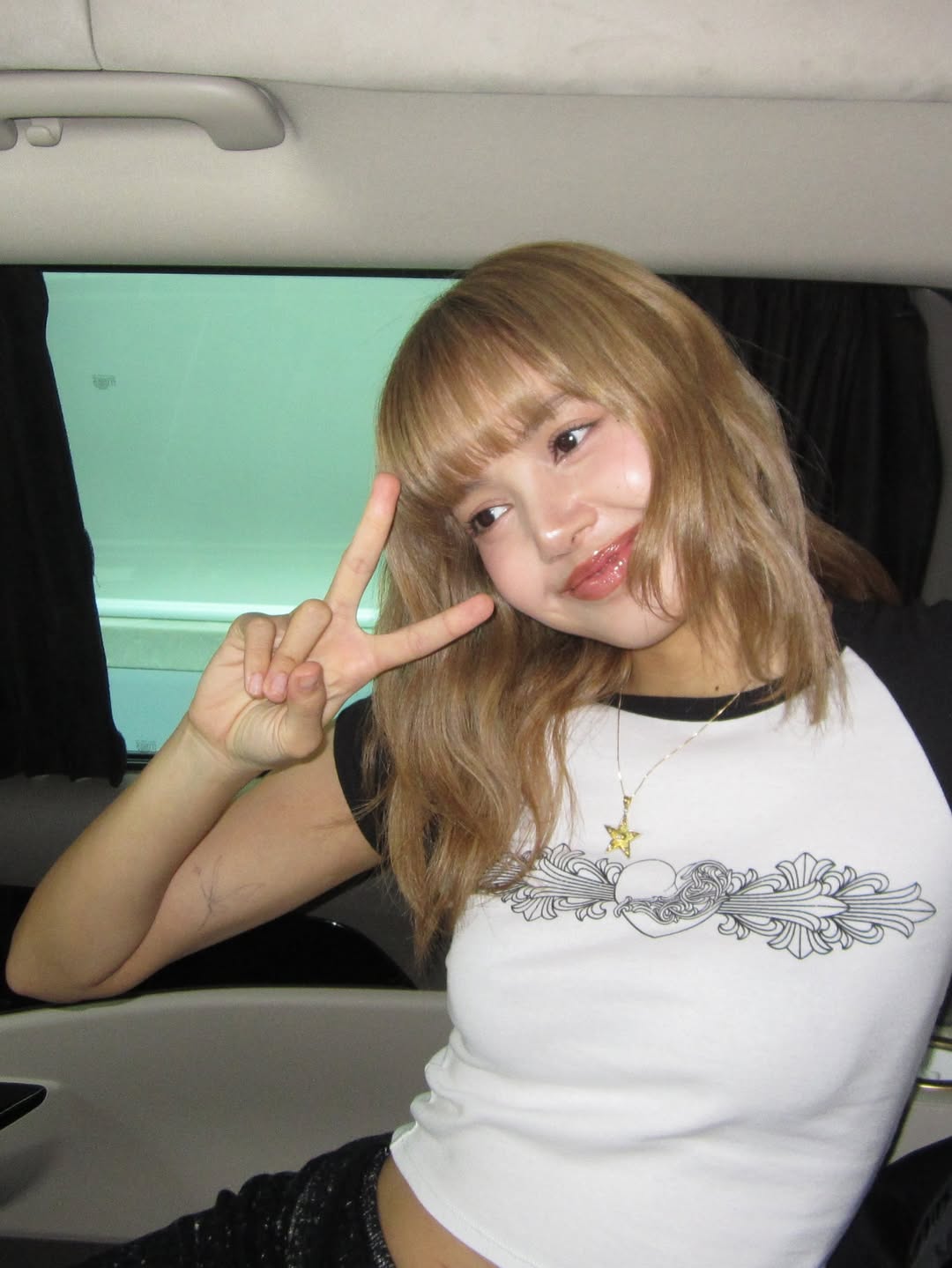 BLACKPINK’s Lisa Breaks Silence On Shocking Injury Photo - Koreaboo