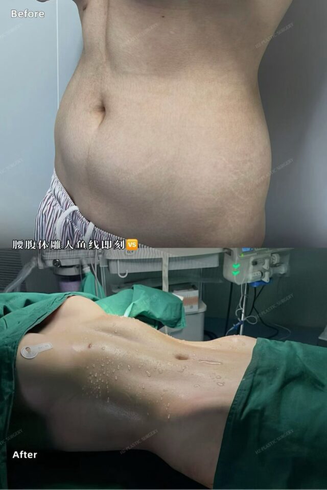 Emerging Plastic Surgery Trend In China Triggers Massive Backlash ...